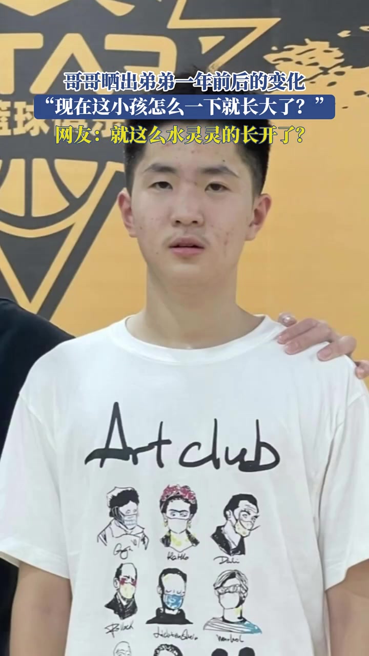 哥哥晒出弟弟一年前后的变化-24VS直播